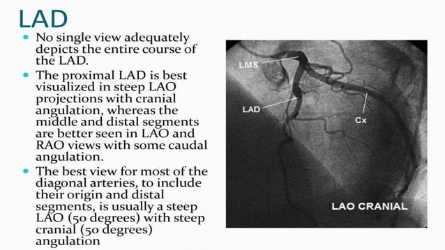 CORONARY__ANGIOGRAM-and-Angiography.pptx