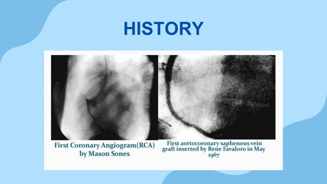 CORONARY__ANGIOGRAM-and-Angiography.pptx
