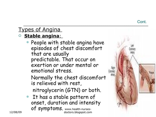 Coronary Artery Disease, Angina pectoris, Myocardial Infarction | PPT