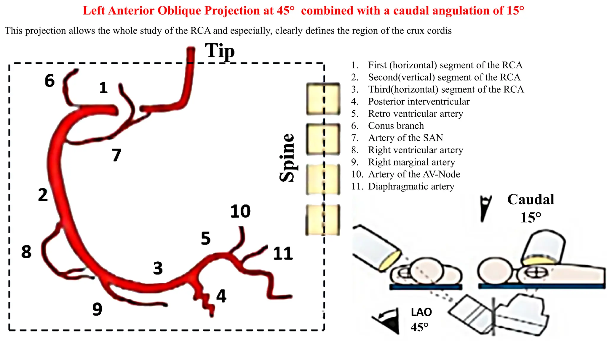 Coronary-artery Circulation Overview Observations about Kugel's artery ...