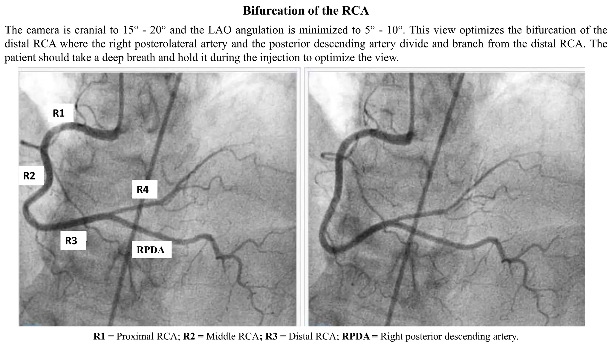 Coronary-artery Circulation Overview Observations about Kugel's artery ...