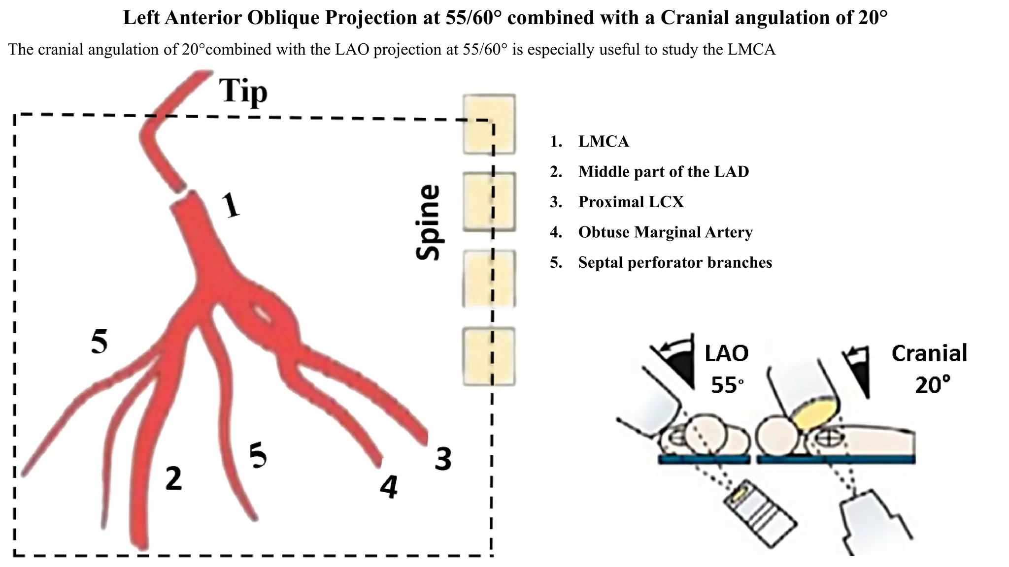 Coronary-artery Circulation Overview Observations about Kugel's artery ...