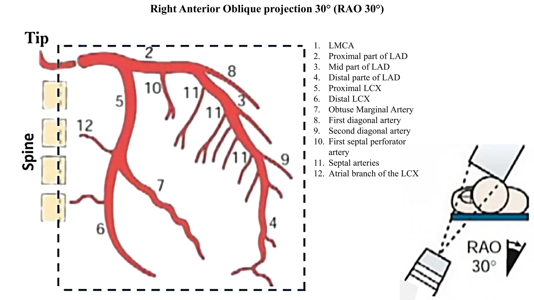 Coronary-artery Circulation Overview Observations about Kugel's artery ...