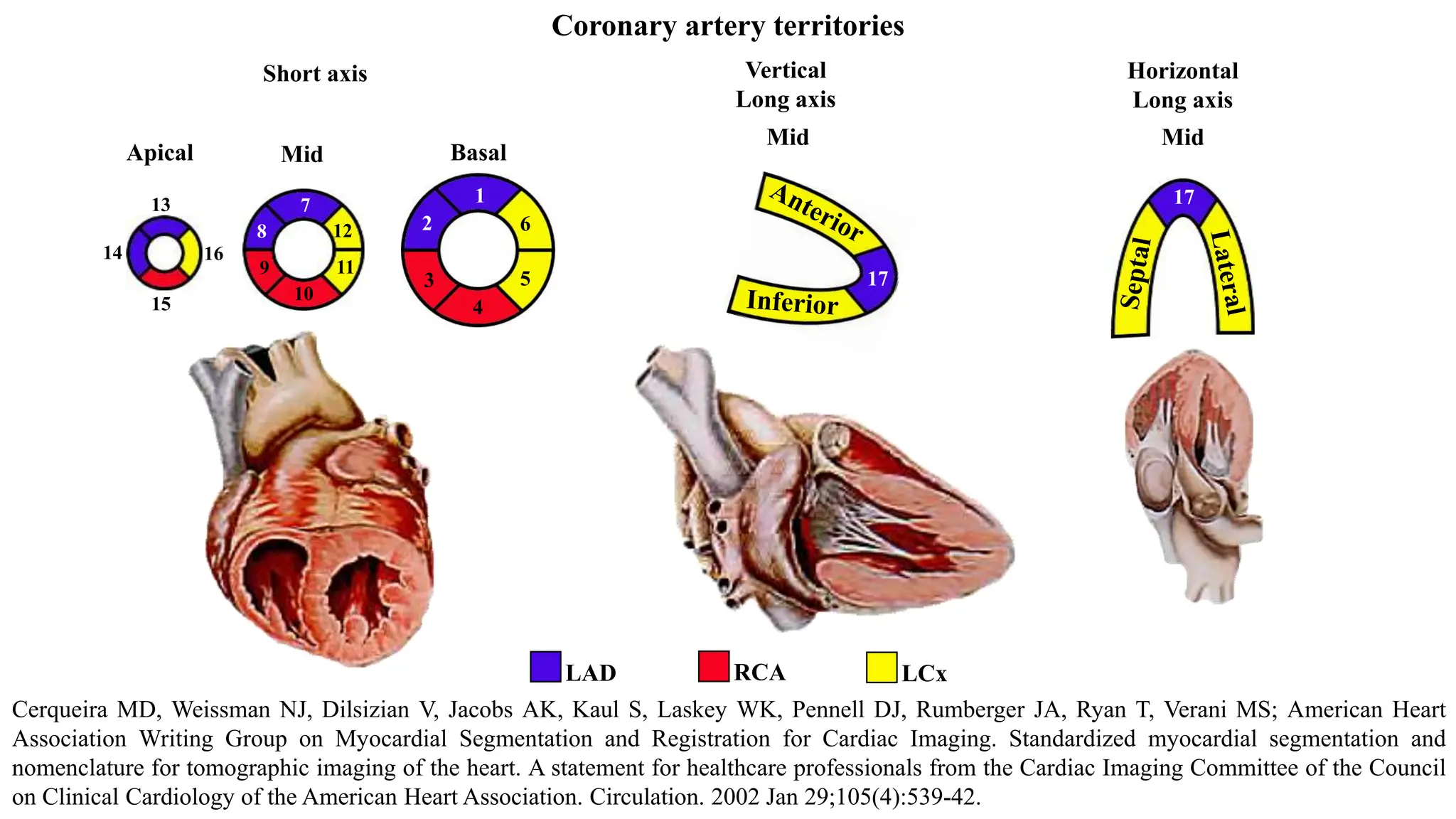 Coronary-artery Circulation Overview Observations about Kugel's artery ...
