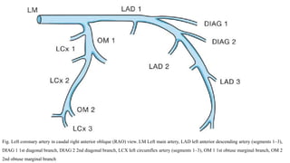 Coronary-artery Circulation Overview Observations about Kugel's artery ...