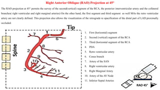 Coronary-artery Circulation Overview Observations about Kugel's artery ...
