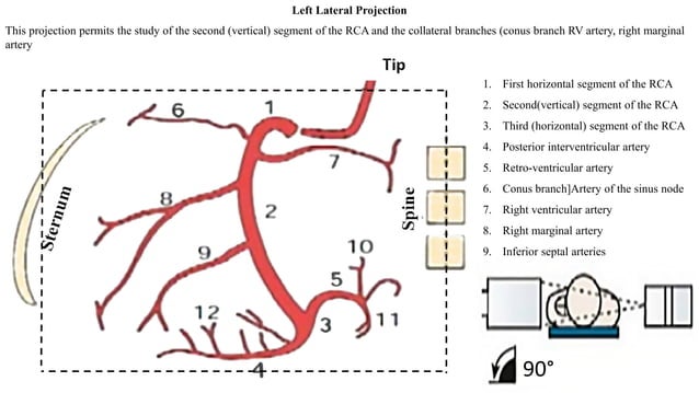 Coronary-artery Circulation Overview Observations about Kugel's artery ...