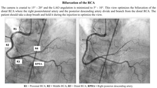 Coronary-artery Circulation Overview Observations about Kugel's artery ...