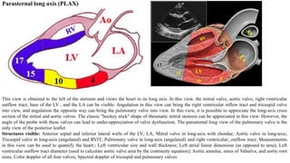 Coronary-artery Circulation Overview Observations about Kugel's artery ...