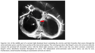 Coronary-artery Circulation Overview Observations about Kugel's artery ...