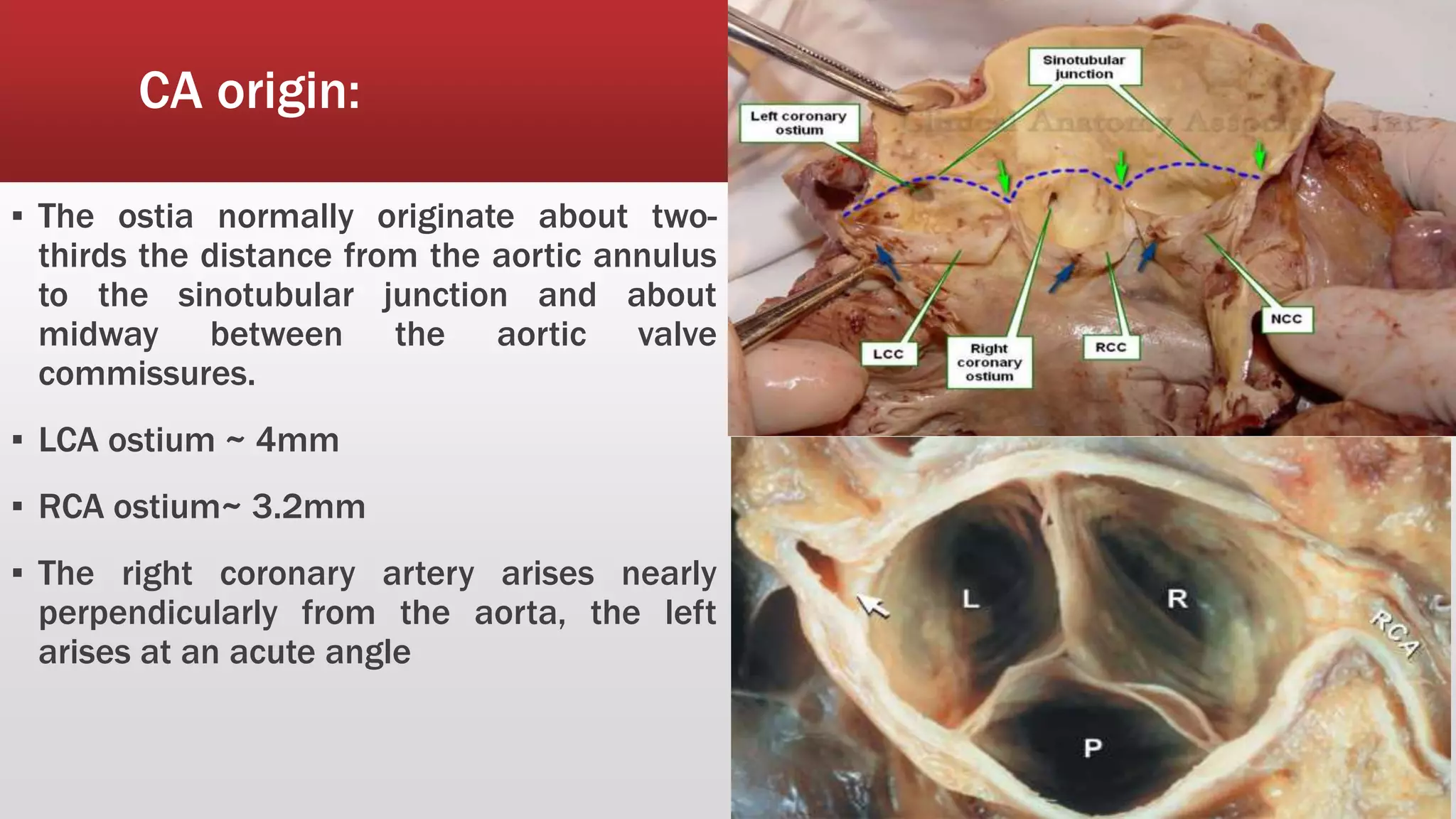 Coronary artery.pptx