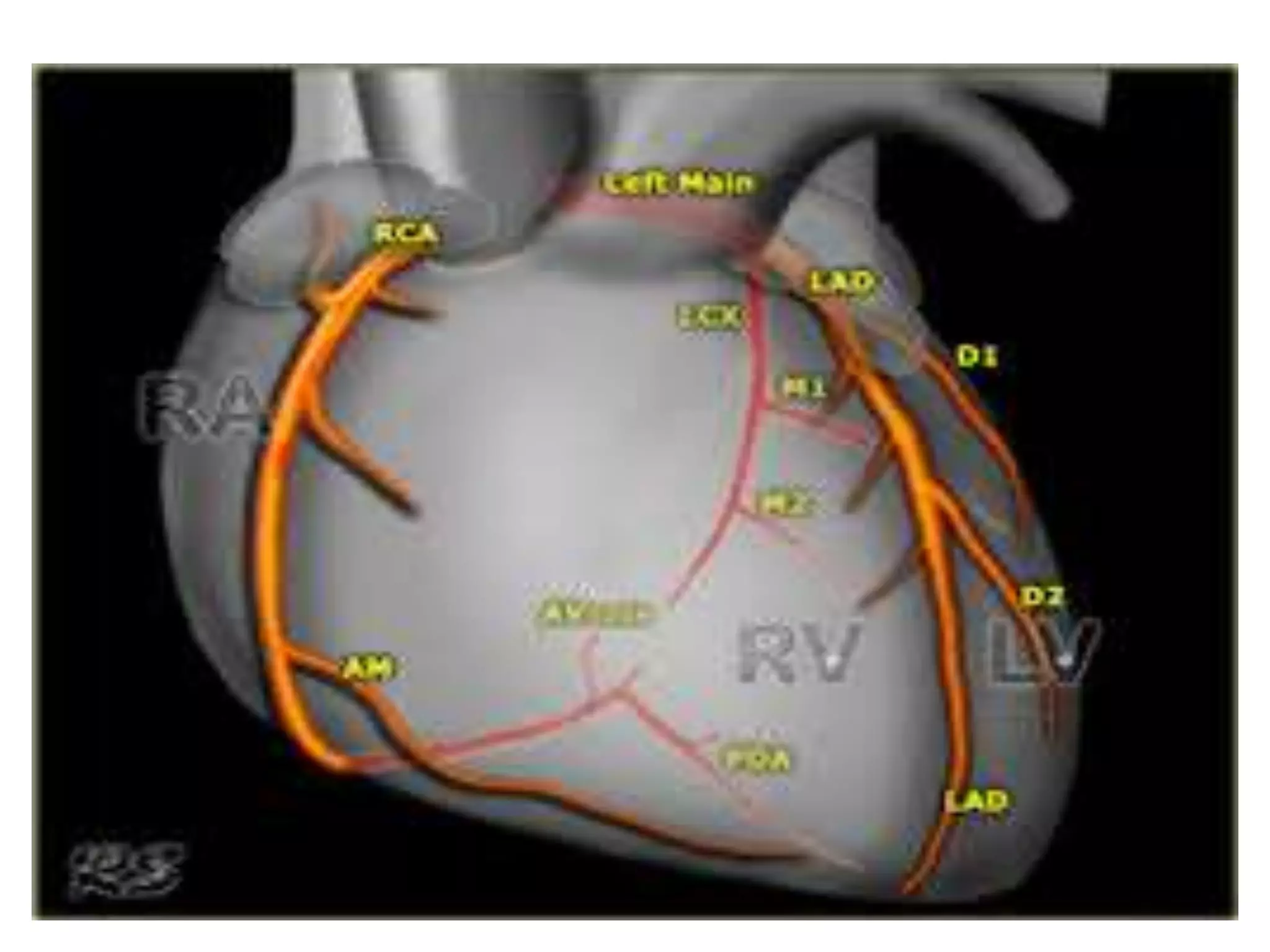 Coronary anatomy for Interventional Cardiologists toufiqur rahman | PPSX