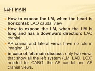 Coronary anatomy | PPT