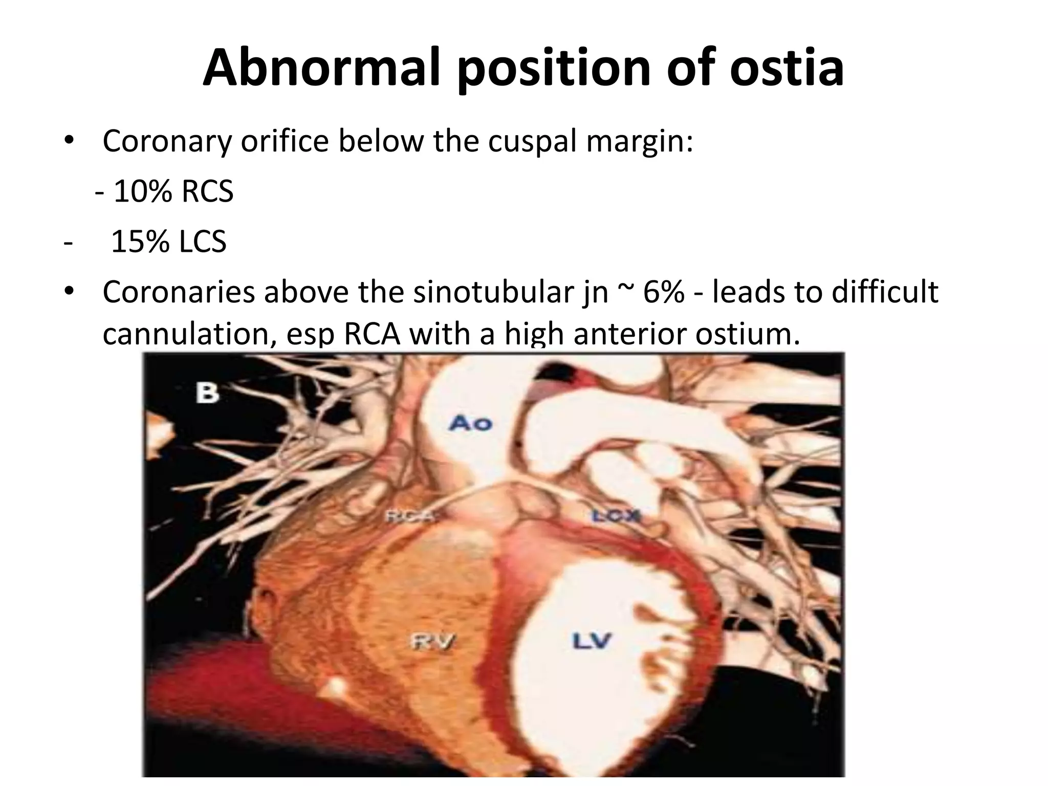 Coronary anatomy and angiographic views | PPTX