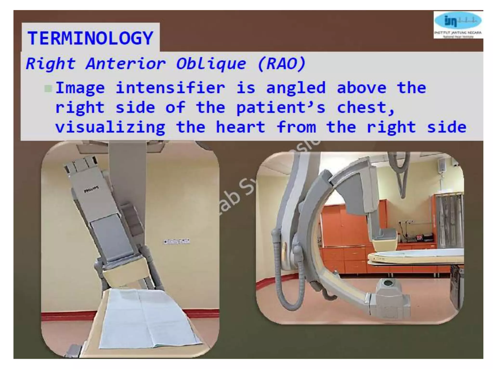 Coronary anatomy and angiographic views | PPTX