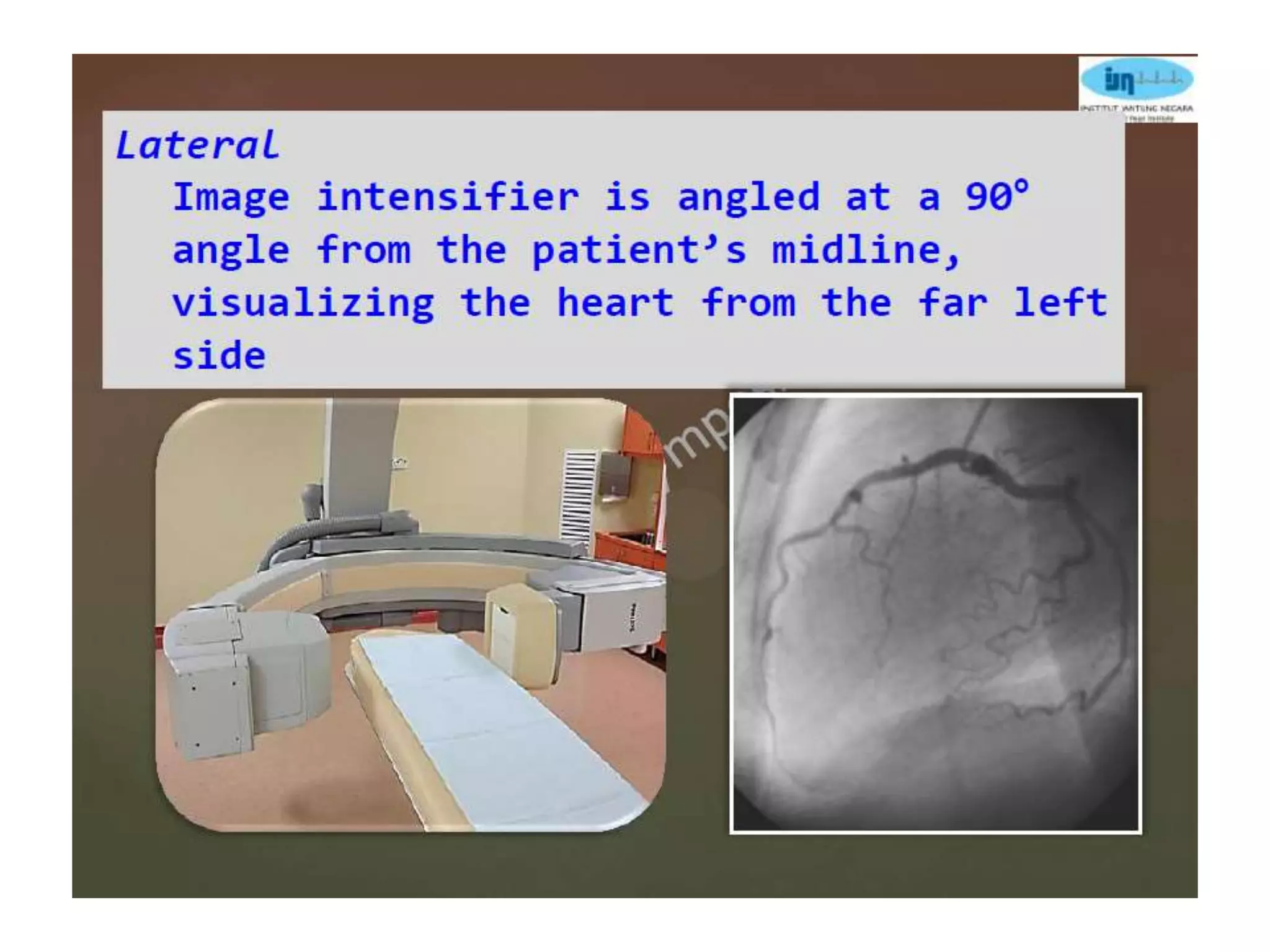 Coronary anatomy and angiographic views | PPTX