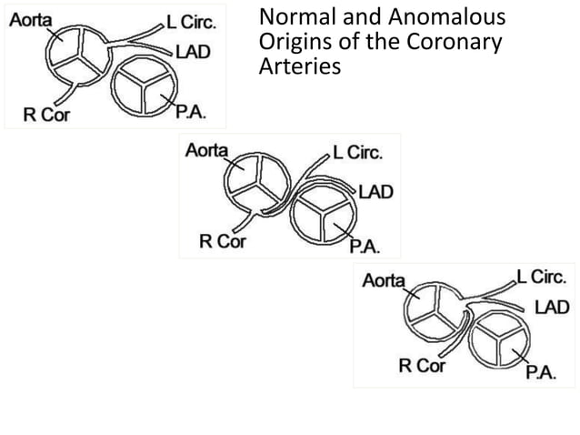 Coronary anatomy and angiographic views | PPTX