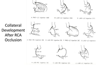 Coronary anatomy and angiographic views | PPTX