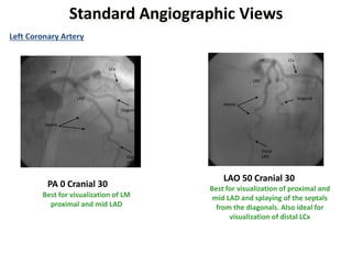 Coronary anatomy and angiographic views | PPTX