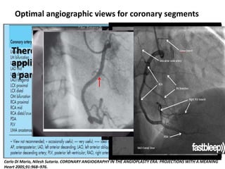 Coronary anatomy and angiographic views | PPTX