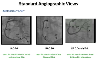 Coronary Angiography Views