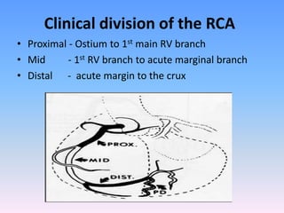 CORONARY ANATOMY _ SANDEEP M CAG VIEWS.ppsx