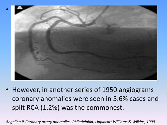 CORONARY ANATOMY _ SANDEEP M CAG VIEWS.ppsx | Heart and Cardiovascular ...