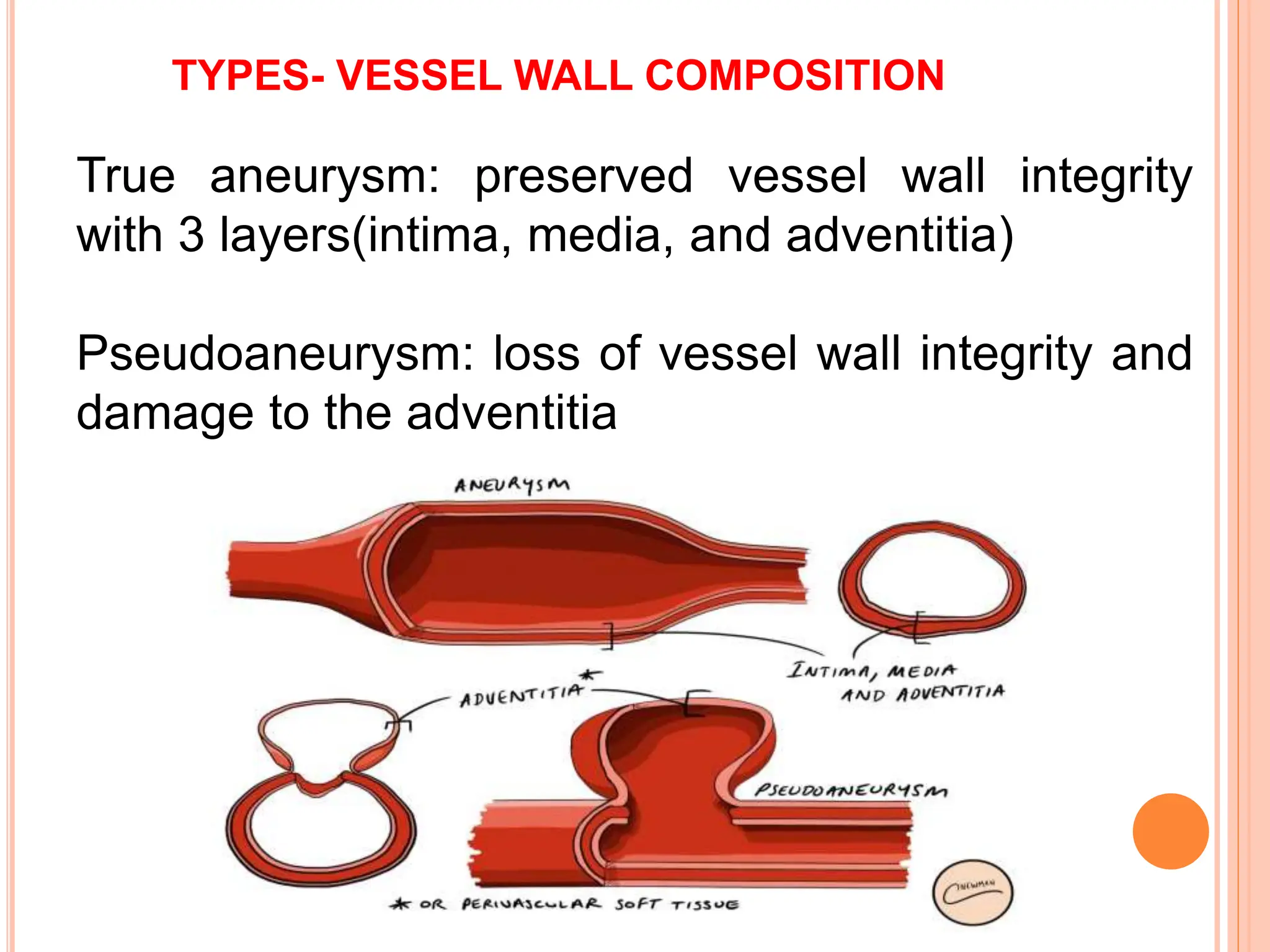 Coronary aneurysm: At a glance and Management.pptx