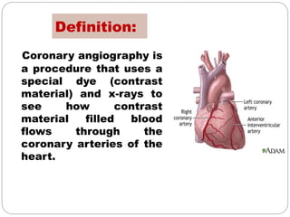 Coronary angiogram | PPTX