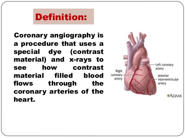 Coronary angiogram