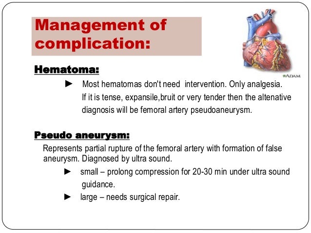 Coronary angiogram