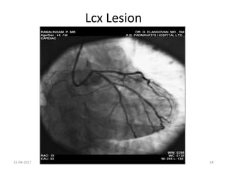 Coronary angiogram an overview | PPT