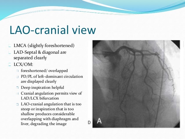 Coronary angiograpgy basic n special views