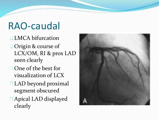 Coronary angiograpgy basic n special views