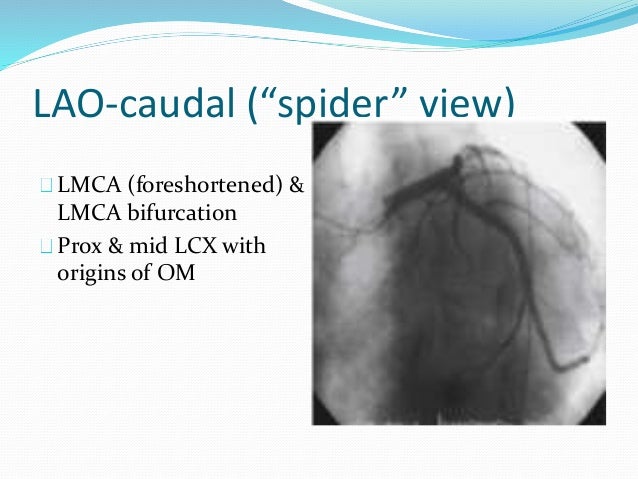 Coronary angiograpgy basic n special views