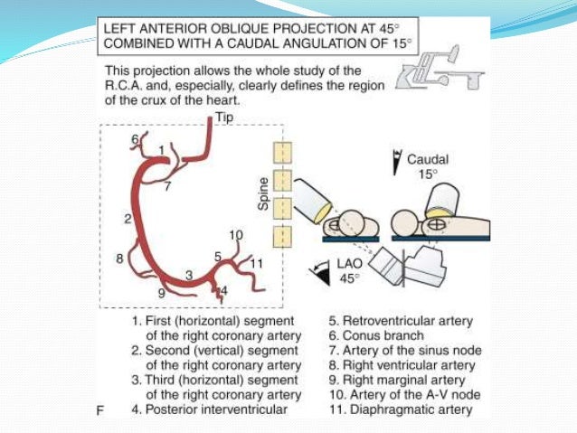 Coronary angiograpgy basic n special views