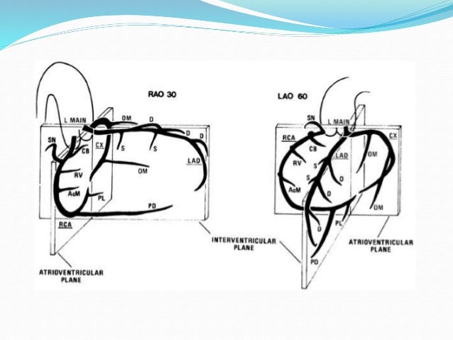 Coronary angiograpgy basic n special views