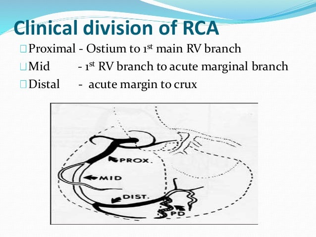 Coronary angiograpgy basic n special views