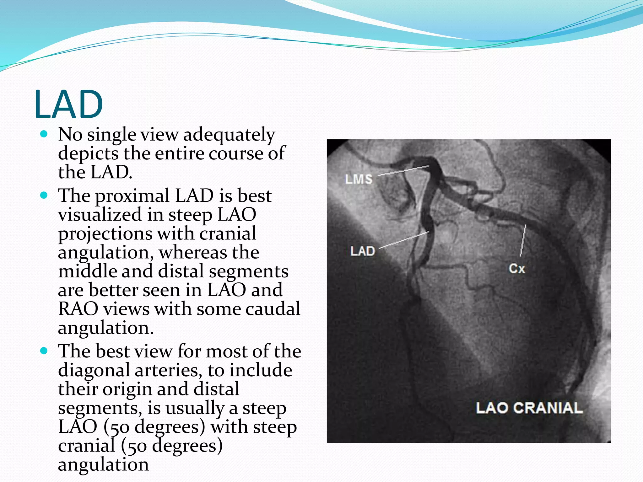 Coronary angiography | PPTX