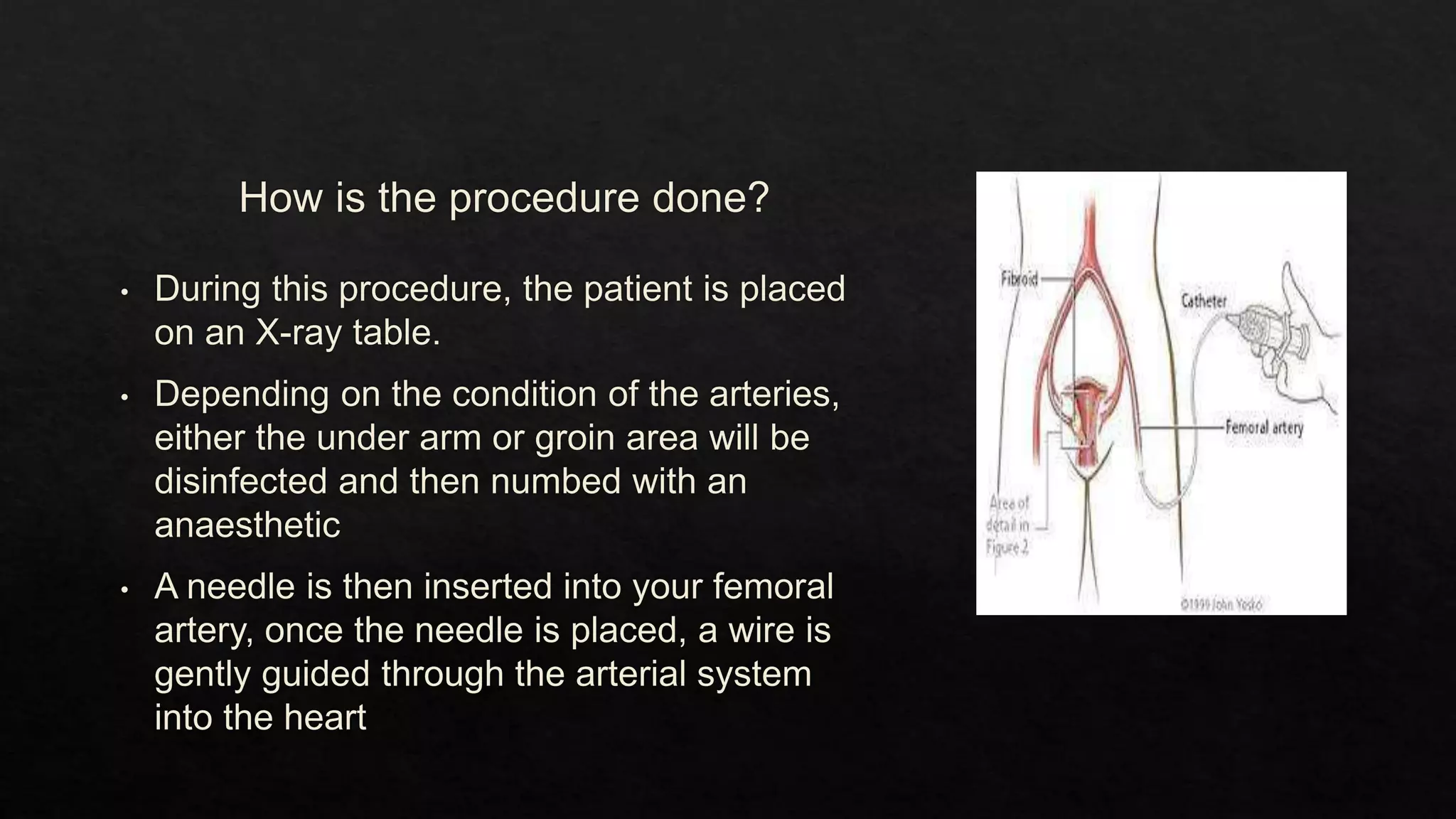 Coronary angiography | PPT
