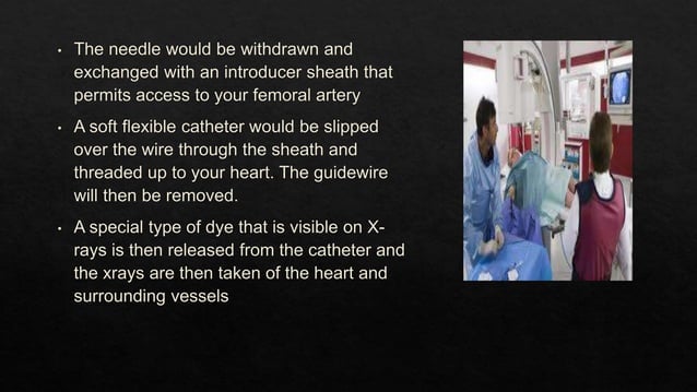 Coronary angiography | PPT