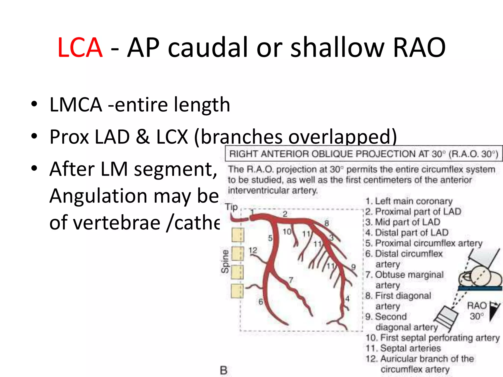 CORONARY ANGIOGRAPHY.pptx