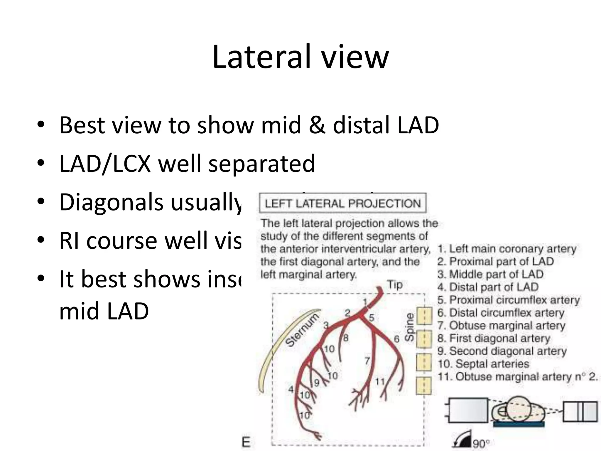 CORONARY ANGIOGRAPHY.pptx