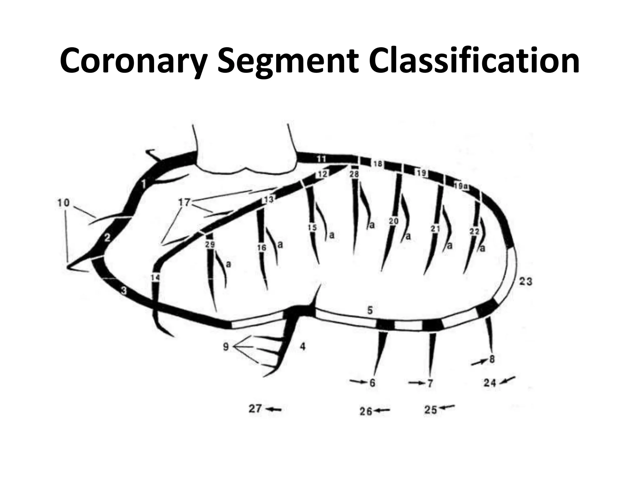 coronaryangiography-220330142539 (1).pdf