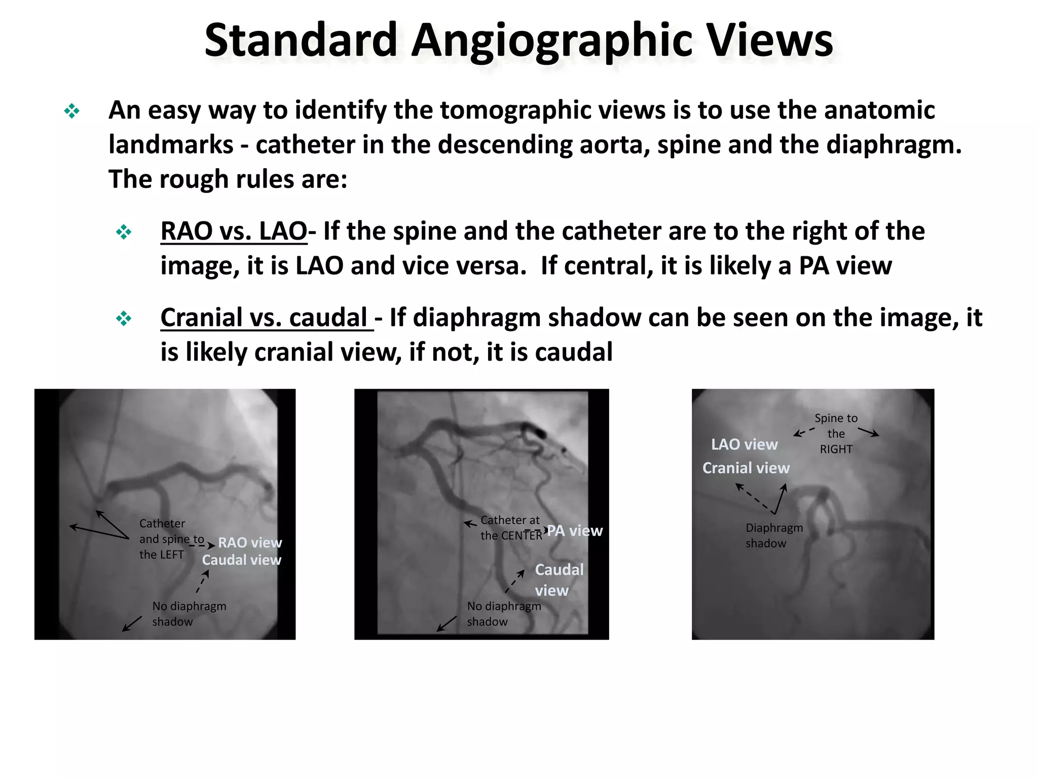 coronaryangiography-220330142539 (1).pdf