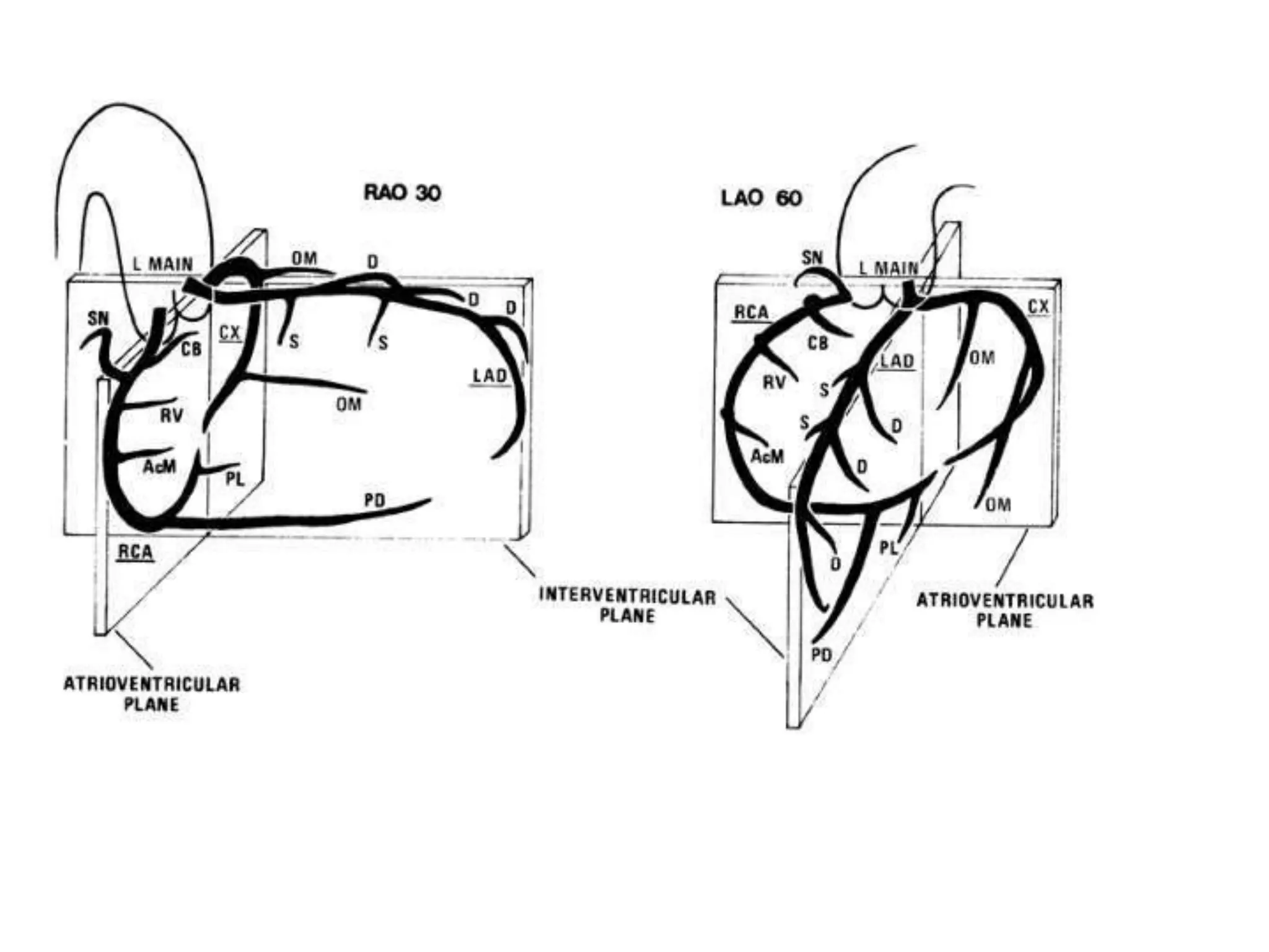coronaryangiography-220330142539 (1).pdf