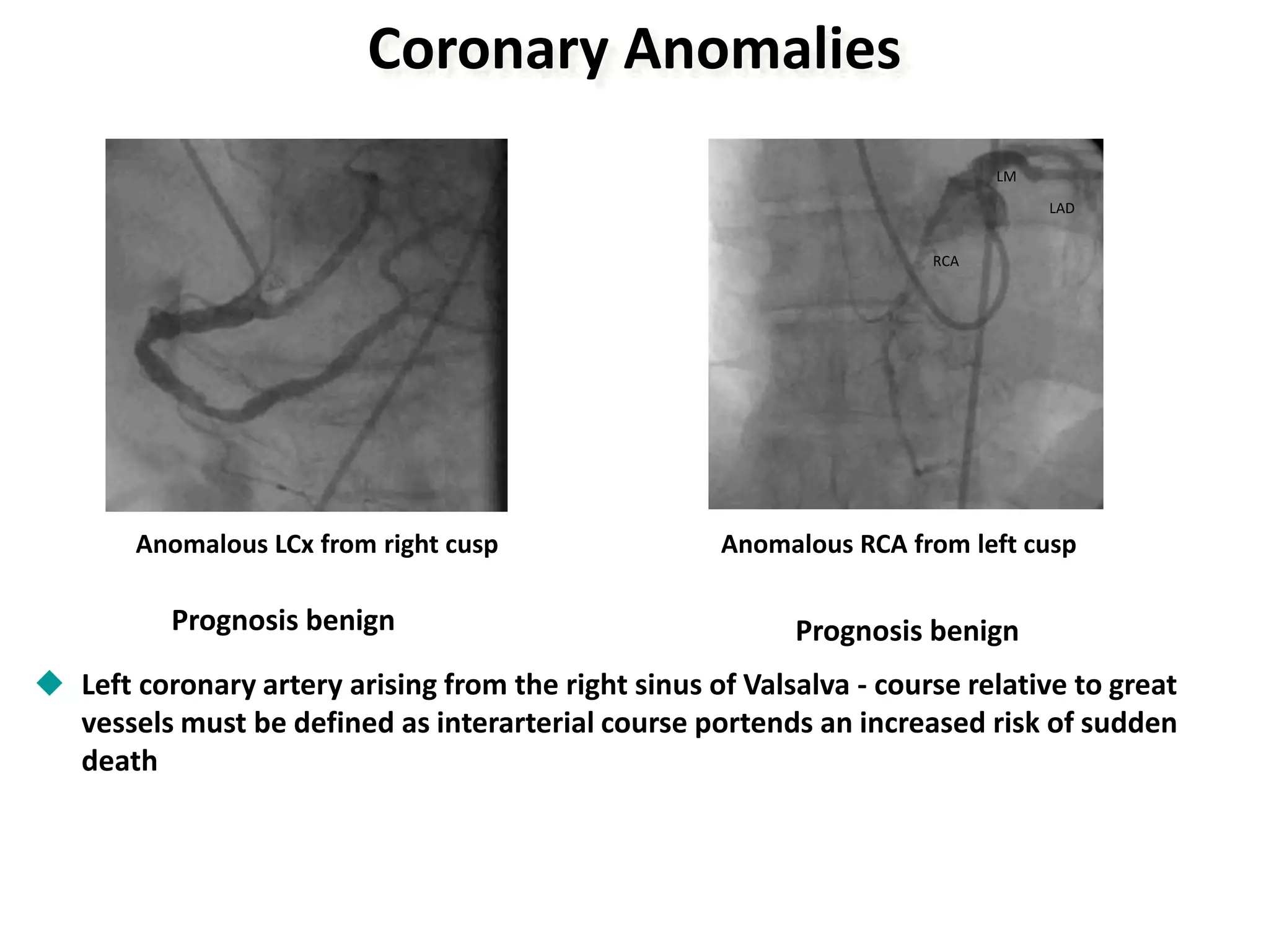 coronaryangiography-220330142539 (1).pdf
