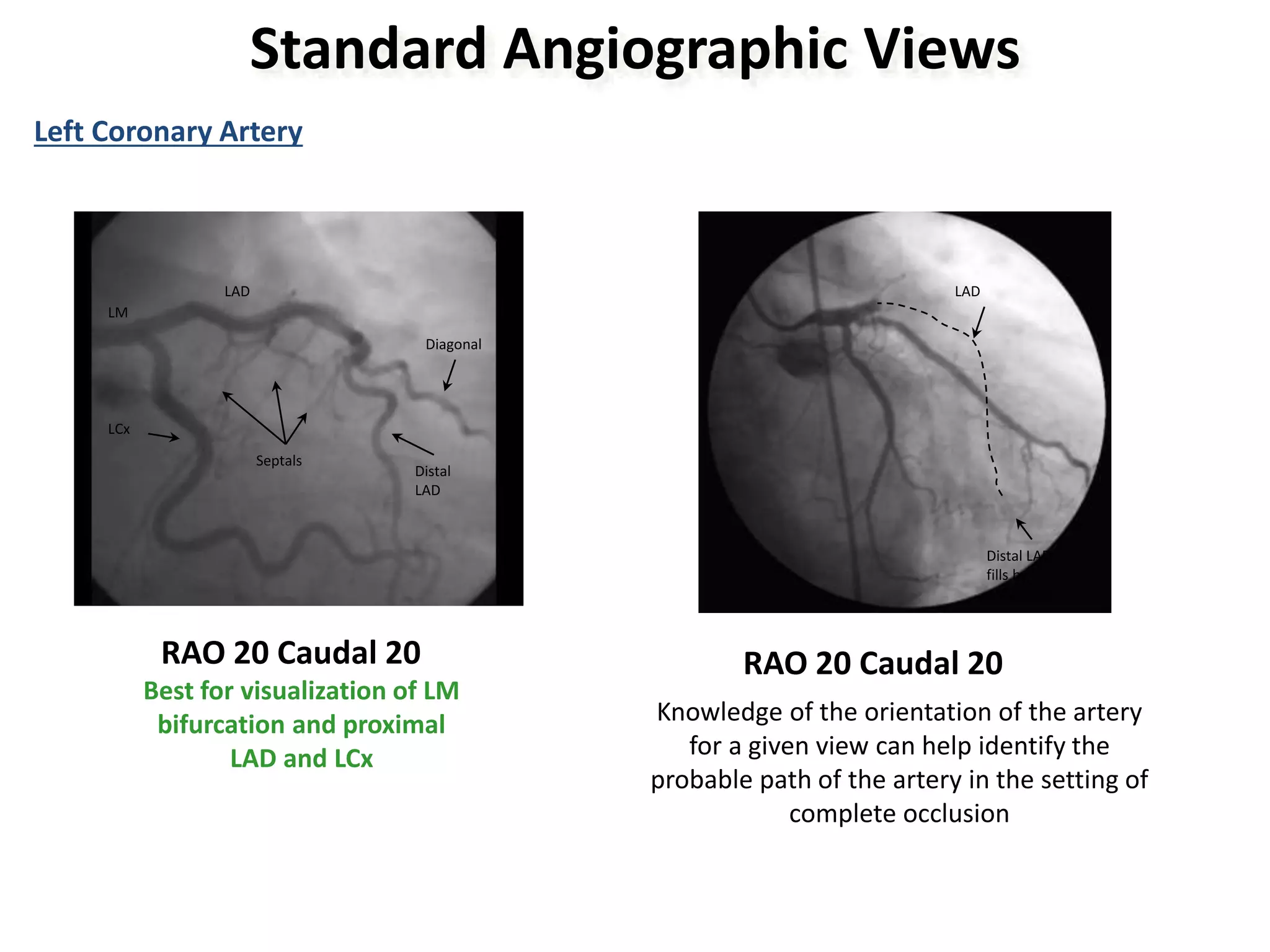 coronaryangiography-220330142539 (1).pdf
