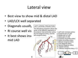 coronaryangiography-220330142539 (1).pdf