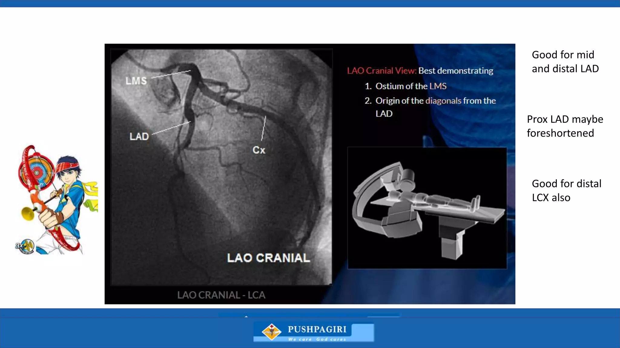 Coronary Angiography - Views - Dr Hafeesh Fazulu - PIMS.pptx